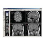 eRAD PACS - Proximus Medical