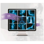 EXA PACS - Proximus Medical