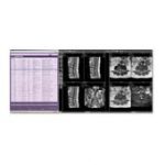 Opal-RAD - Proximus Medical