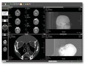 Opal-RAD - Proximus Medical
