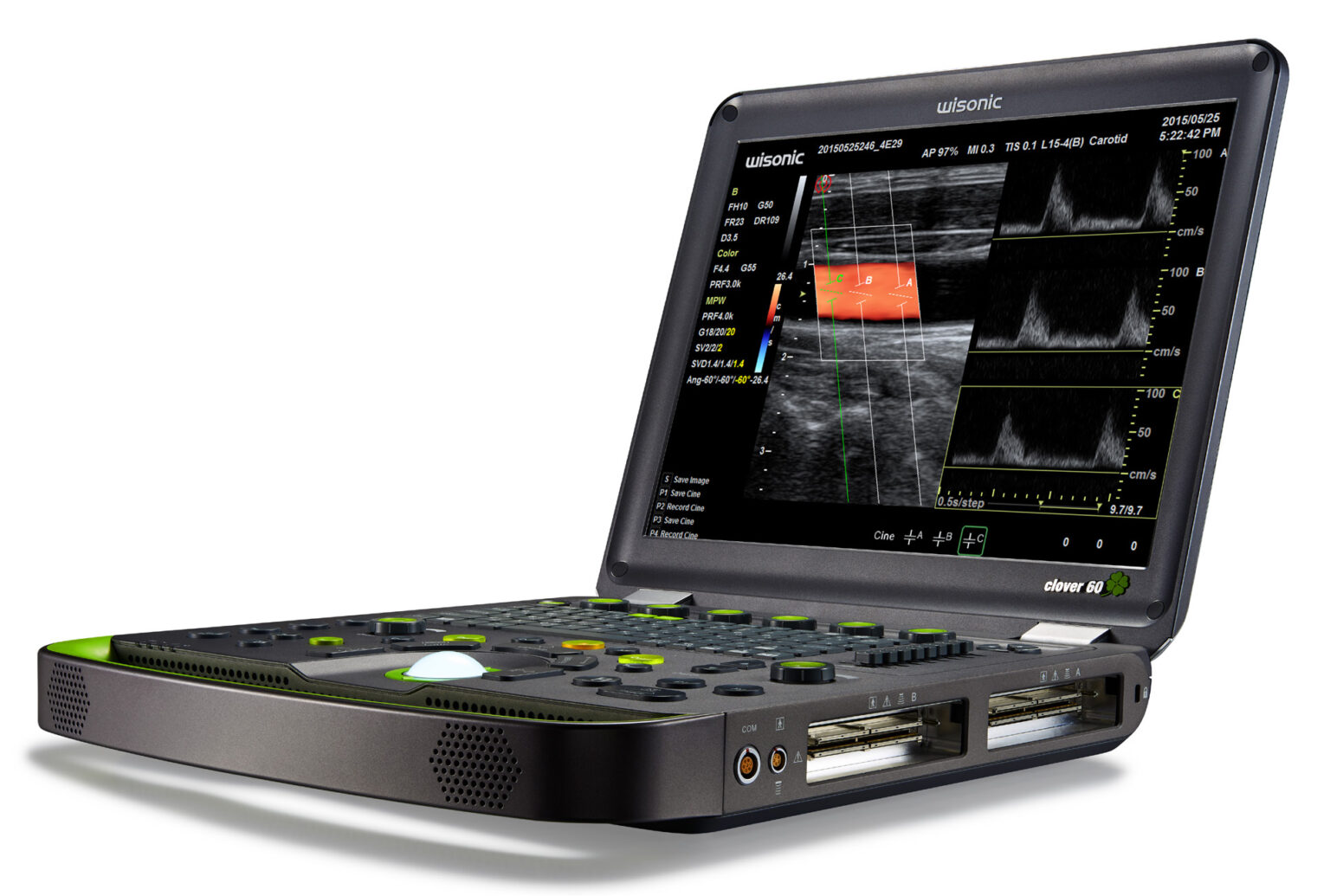 Wisonic Clover - Proximus Medical