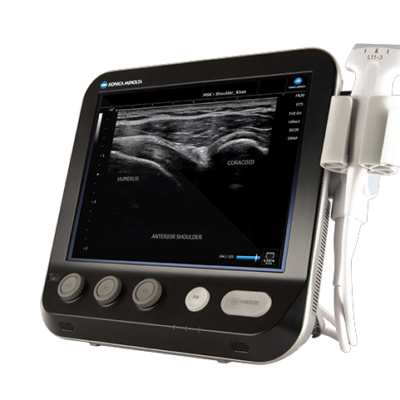 Unlocking the Benefits of Portable Ultrasound Systems for Your Facility ...
